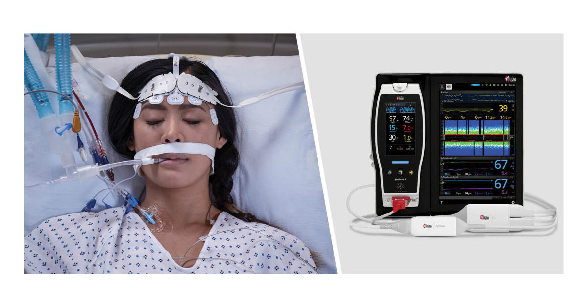 Une étude examine la capacité de Masimo O3® à surveiller les patients ...