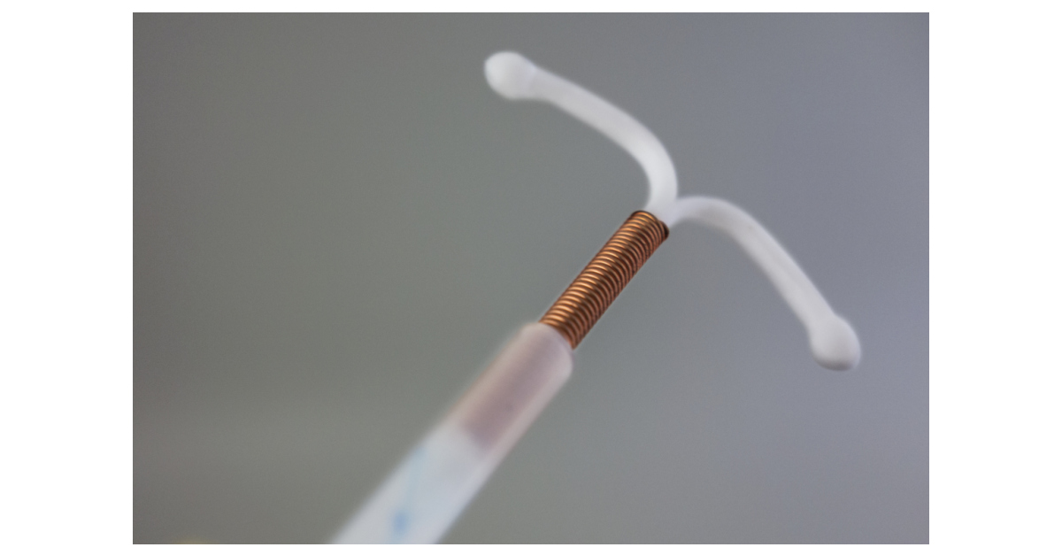 Paragard IUD Linked to Breakage, Serious Surgeries to Remove Pieces ...