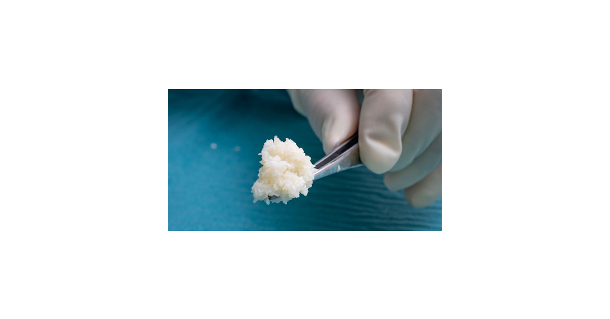 Fish Skin Company Kerecis Announces Kerecis Omega3 MicroGraft ...
