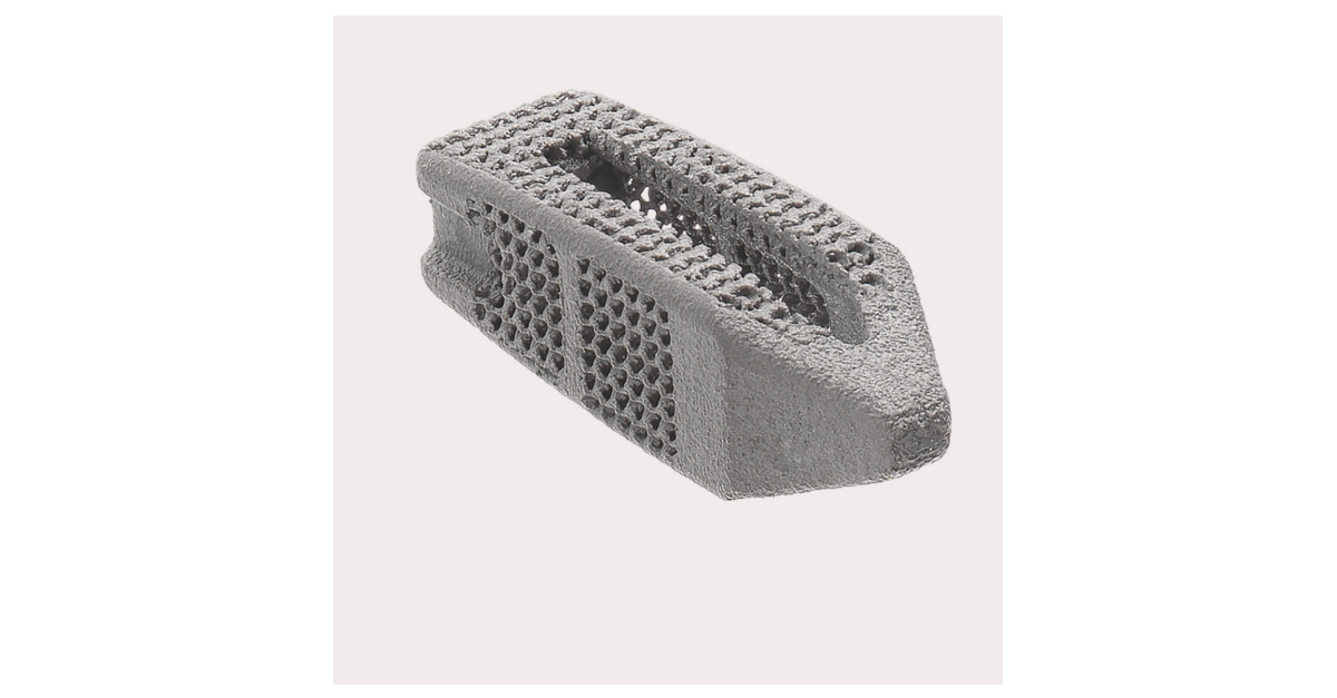 Orthofix Announces U.S. Launch and First Patient Implant of 3D-Printed ...