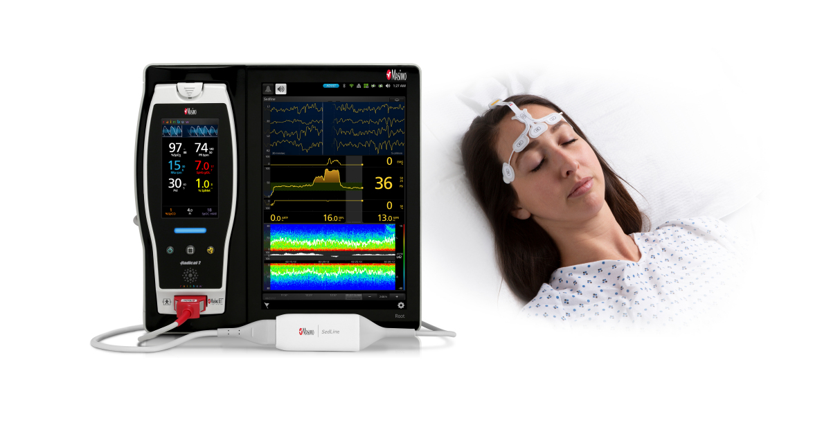 New Study Evaluates the Ability of Masimo SedLine® Brain Function ...
