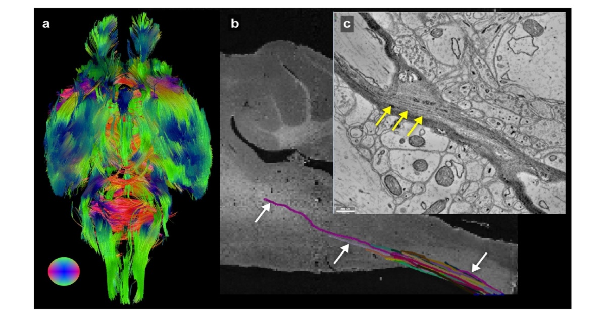 Researchers Image an Entire Mouse Brain for the First Time | Business Wire