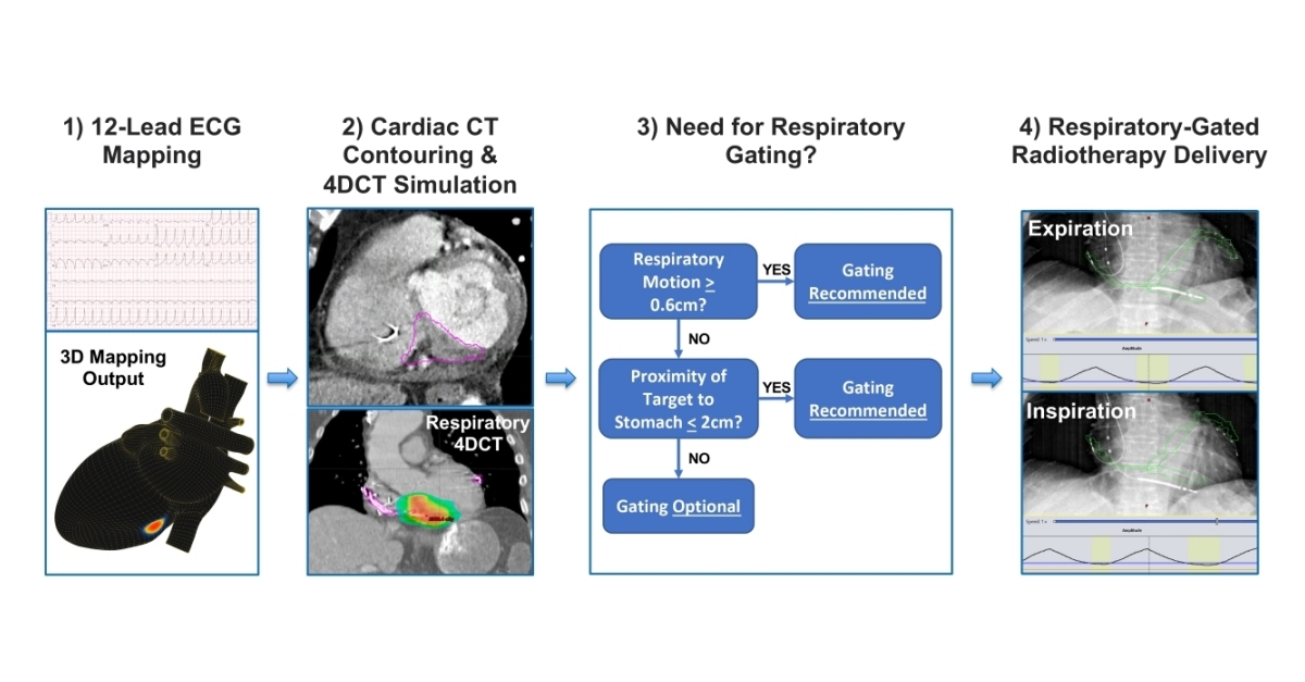Vektor Medical's vMap™ Mapping System Reported as Feasible and ...