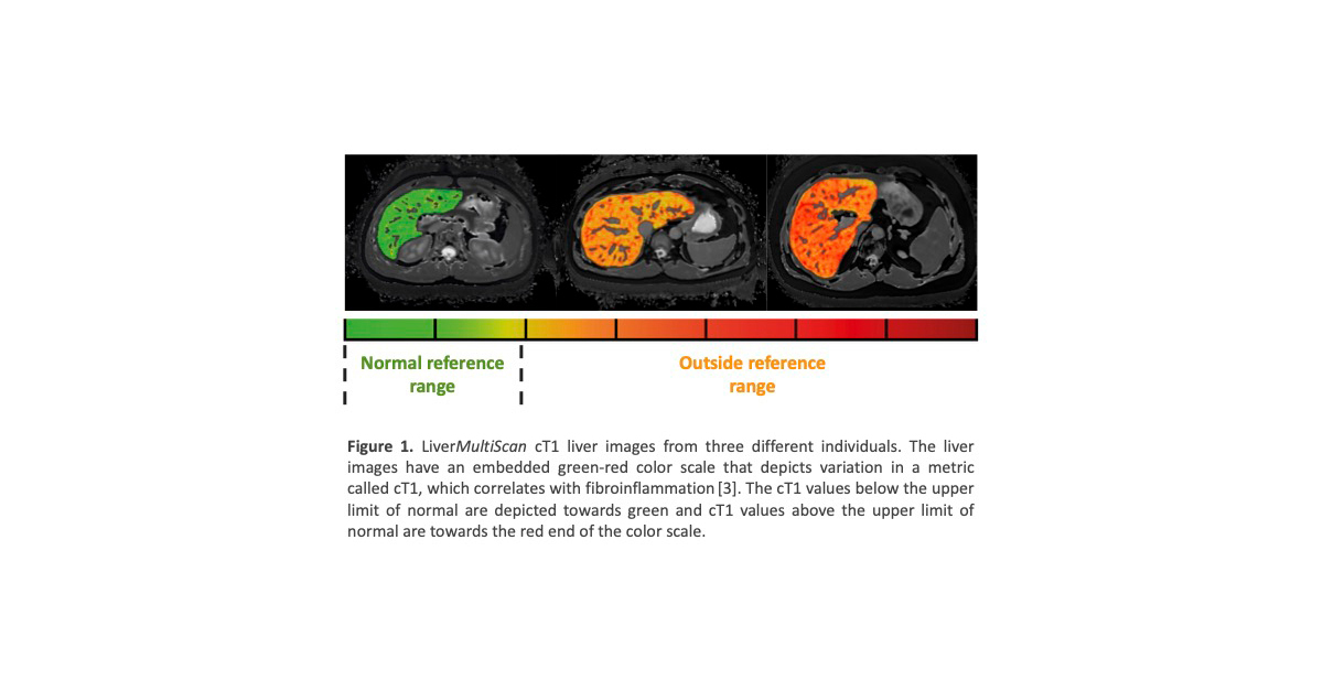 New study finds Perspectum’s LiverMultiScan may positively impact ...