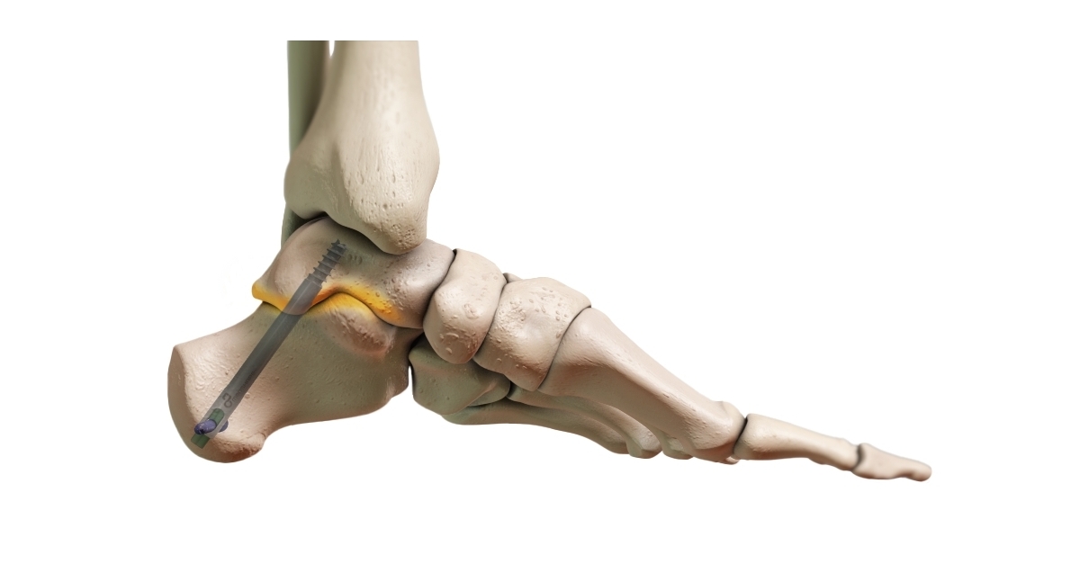 DJO® Expands Active, Adaptive Healing Offerings with Introduction of ...