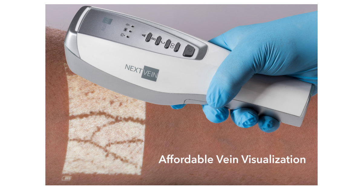 NextVein Announces Affordable, High-Performance, Handheld Vein ...