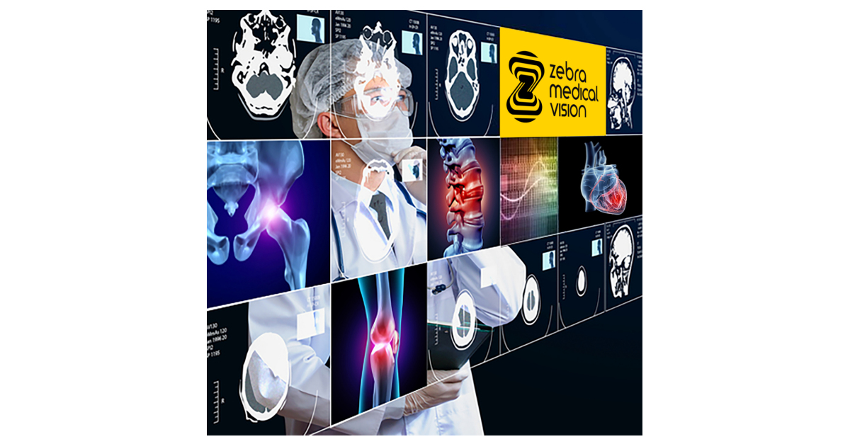 Zebra Medical Vision Secures 8th FDA Clearance for its Coronary Artery ...