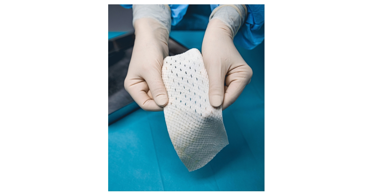 Kerecis Announces First-Ever Fish-Skin Implantable Medical Product for ...
