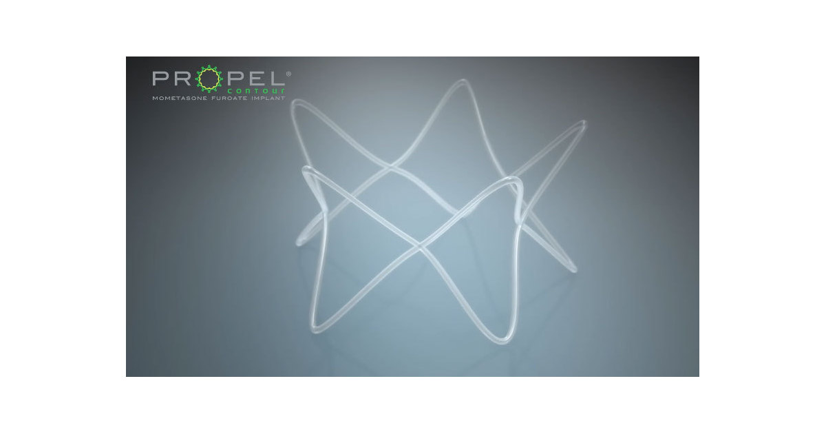 First Implants of PROPEL® Contour in Patients with Chronic ...