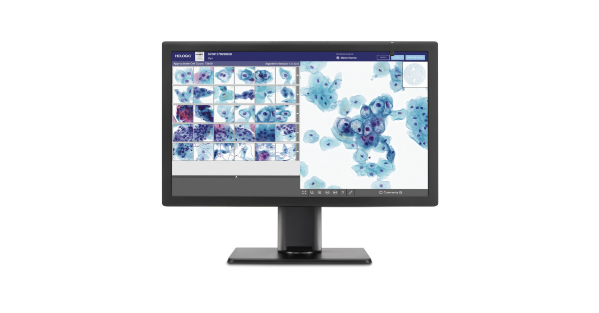 Hologic Announces European Launch of Genius™ Digital Diagnostics System ...