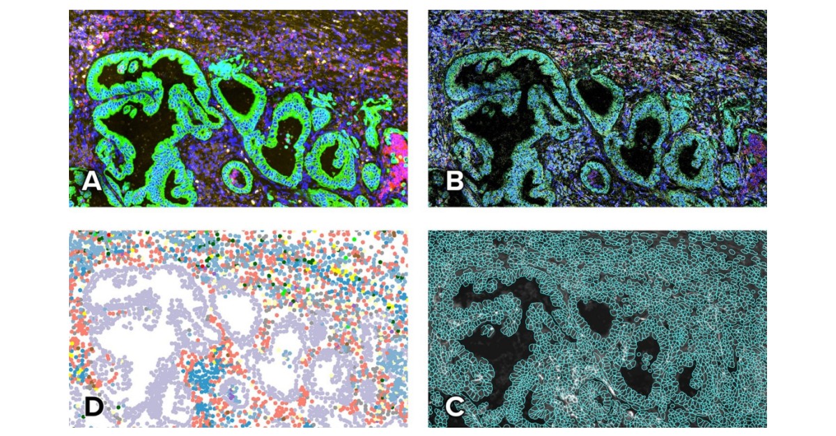 NanoString Releases High-Resolution FFPE Tissue Dataset Generated Using ...