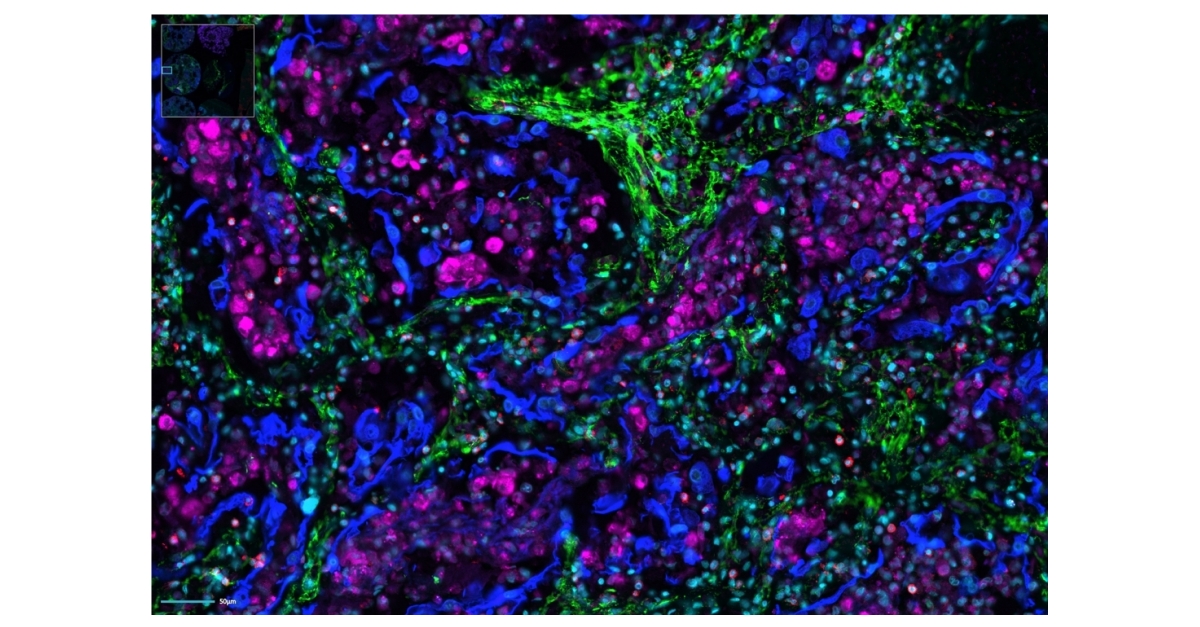 Lunaphore highlights novel spatial biology research at SITC 2021 ...