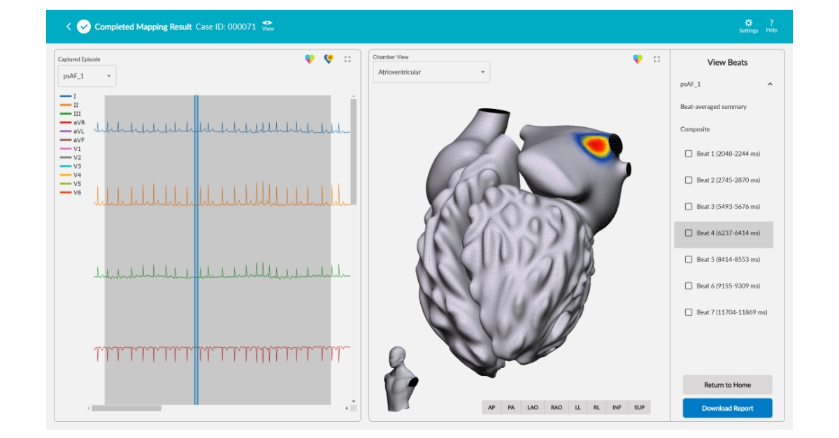 Vektor Medical Receives FDA Clearance for vMap™, First Technology ...