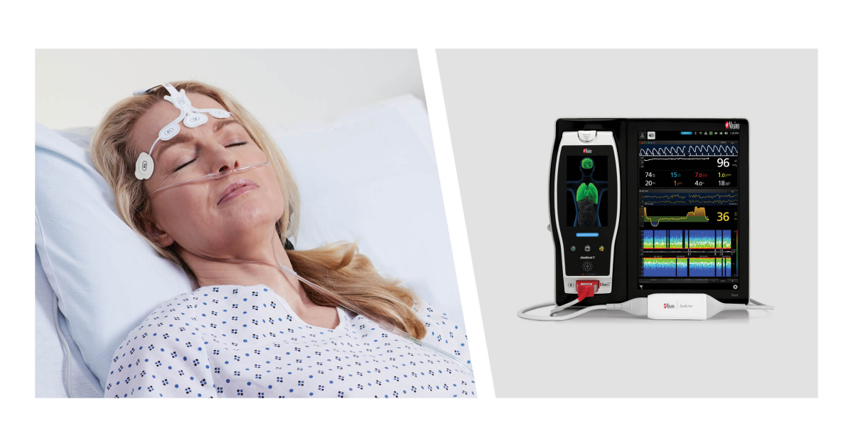 新研究顯示，Masimo SedLine®腦功能監護儀或有助於及早識別有術後譫妄風險的患者 | Business Wire