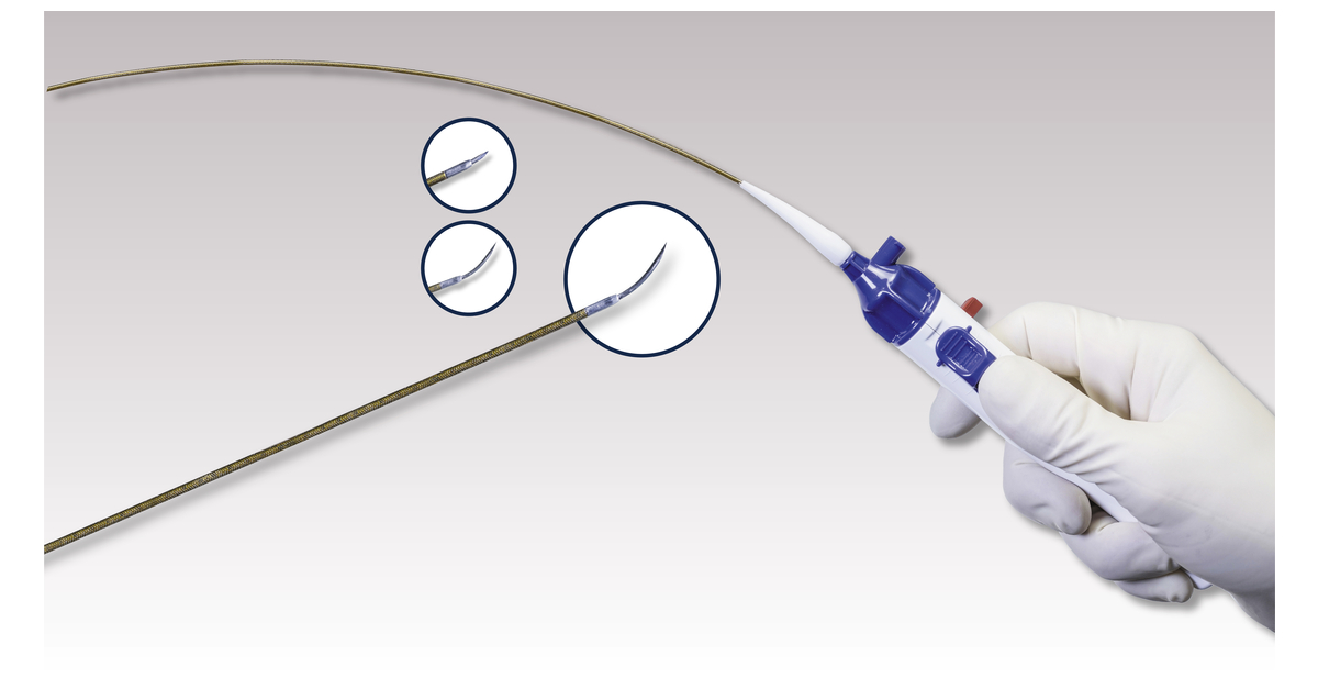 Upstream Peripheral’s GoBack CTO Catheter Aces its Exam | Business Wire