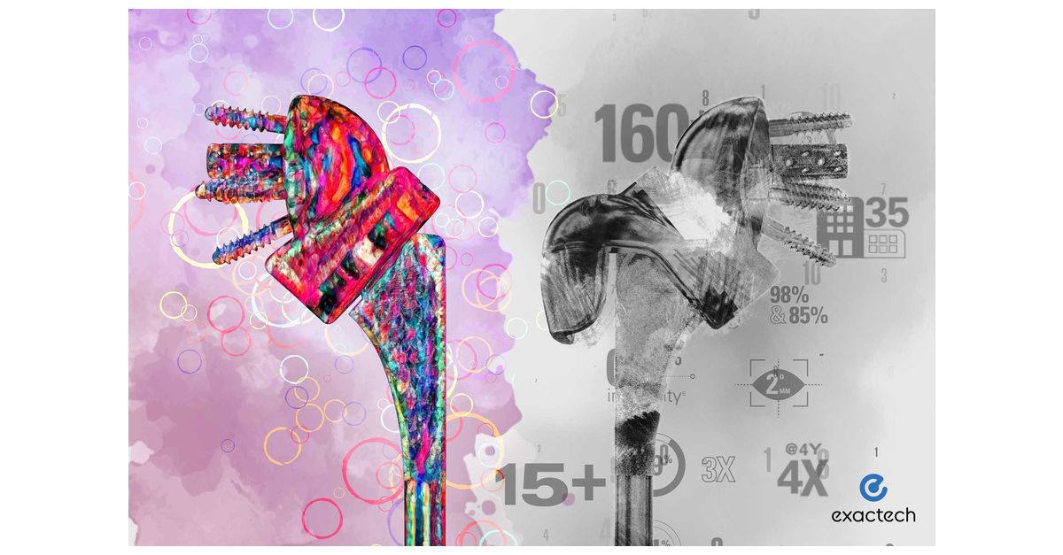 Exactech Celebrates 15 Years of Clinical Use: Equinoxe® Reverse ...