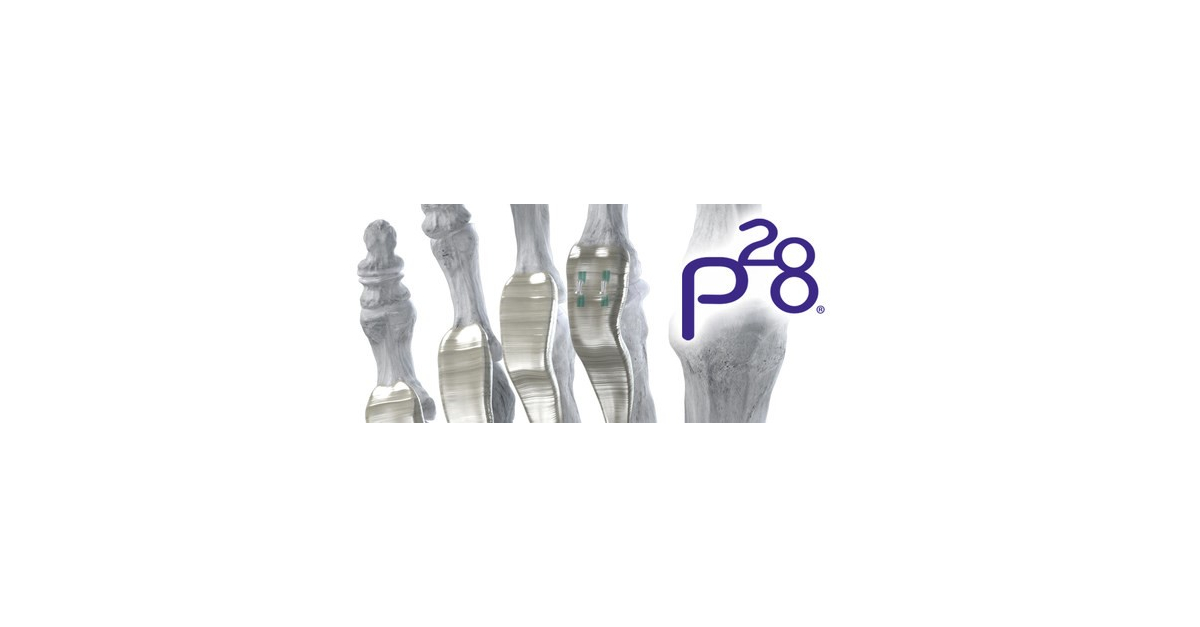 Paragon 28 Launches Paratrooper™ Plantar Plate System for Hammertoe and ...