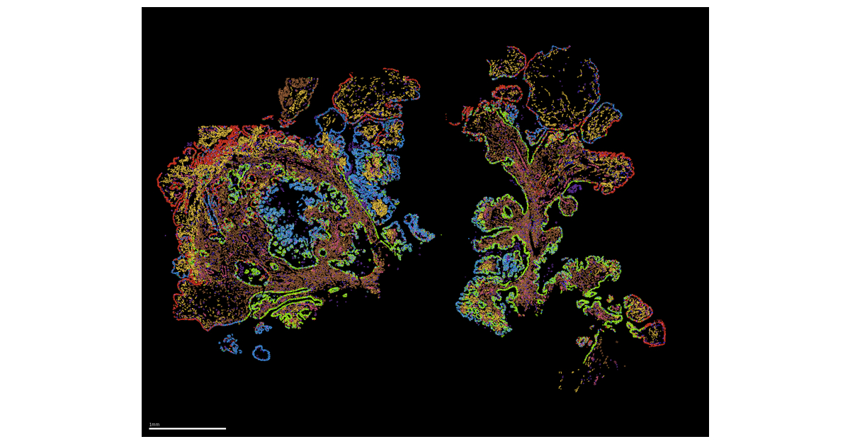 Vizgen Showcases Expansion of MERSCOPE™ In Situ Single-Cell Spatial ...