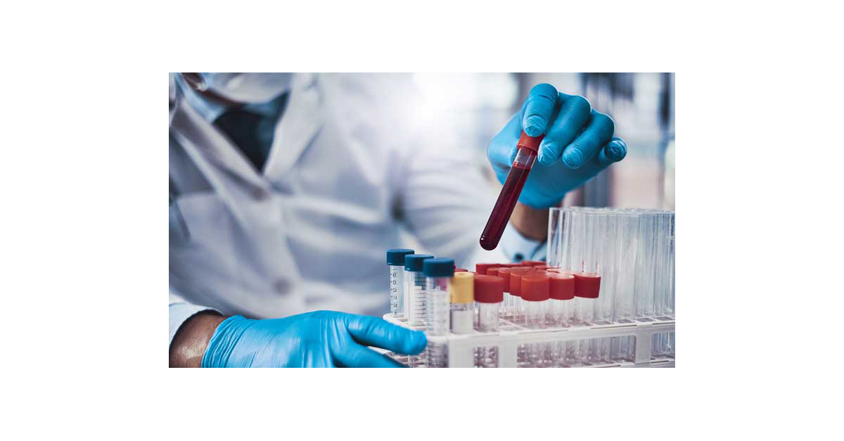 Labcorp Launches New Test to Identify and Confirm Neurodegenerative ...