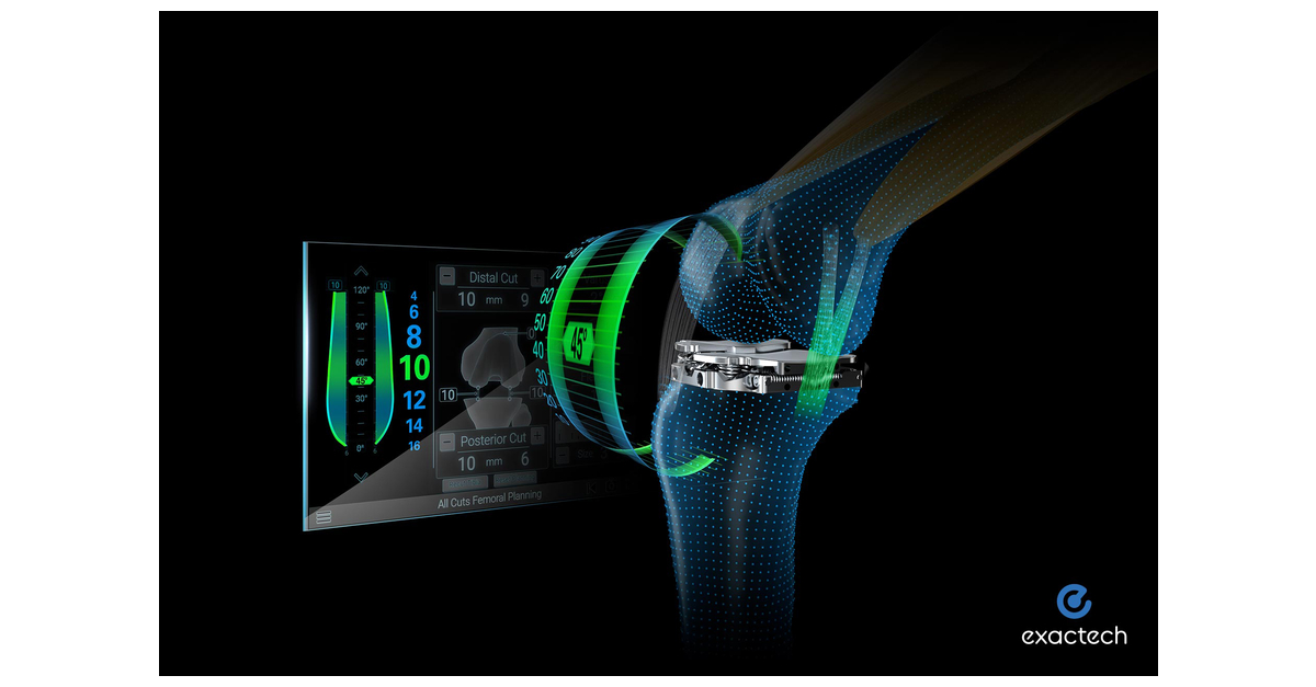 Exactech Announces Successful First Surgeries with Latest ...
