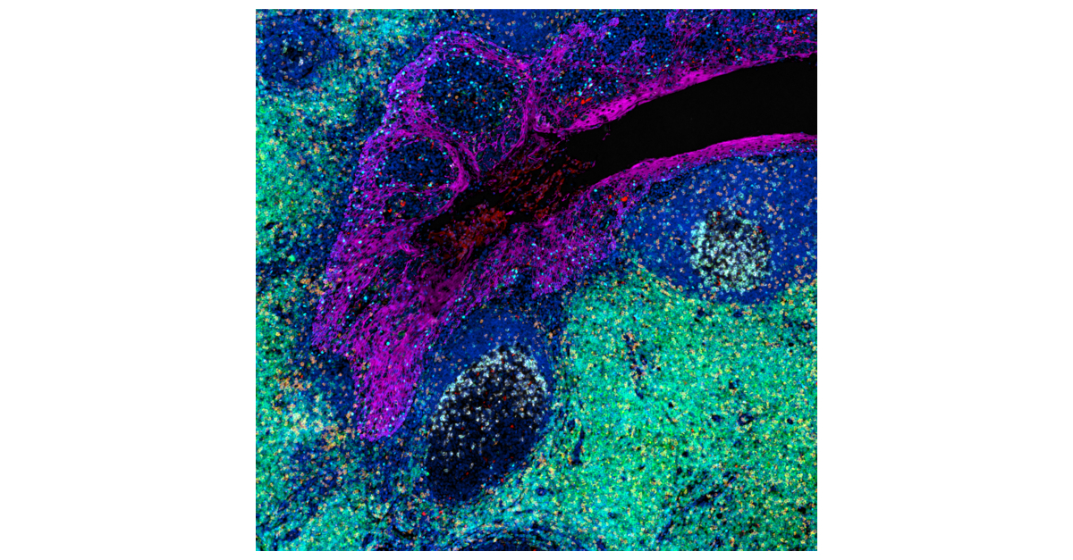 Nucleai and Propath UK announce partnership for end-to-end AI-powered ...