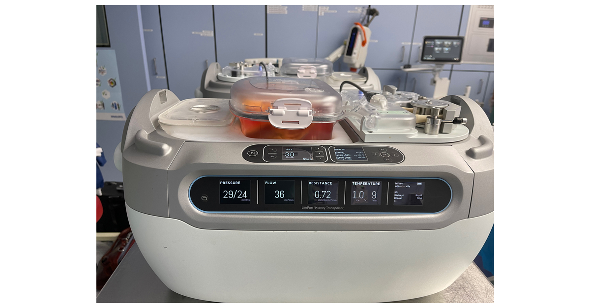 Riassunto: Il dispositivo per il trasporto di reni LifePort® di Organ Recovery Systems si è ...