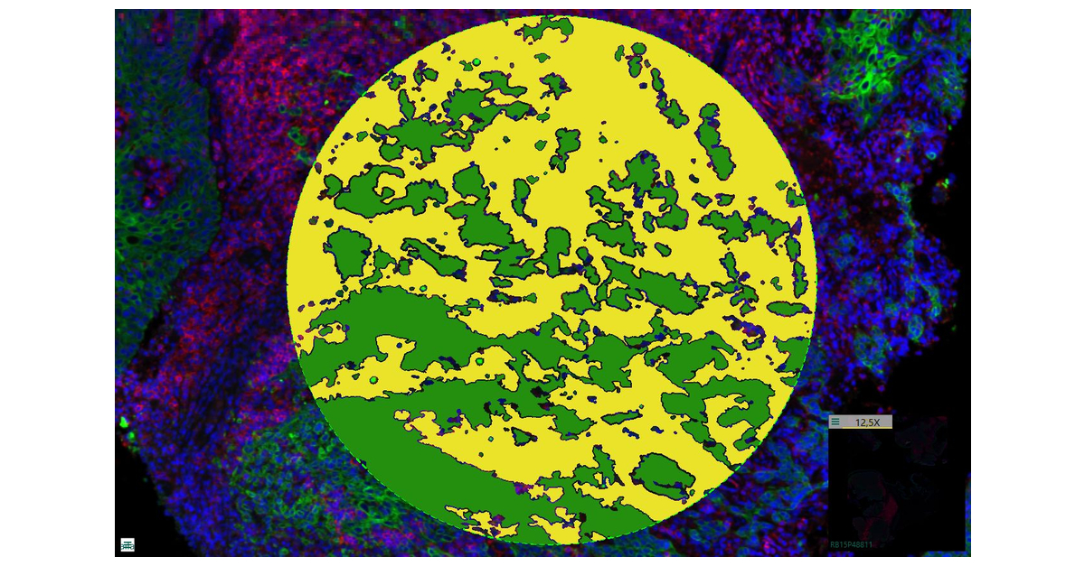 NanoString and Visiopharm Announce Collaboration to Co-develop ...