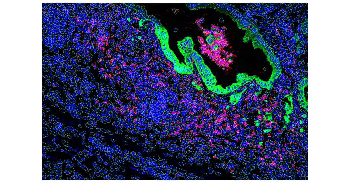 NanoString’s CosMx Spatial Molecular Imager Recognized by The Scientist ...
