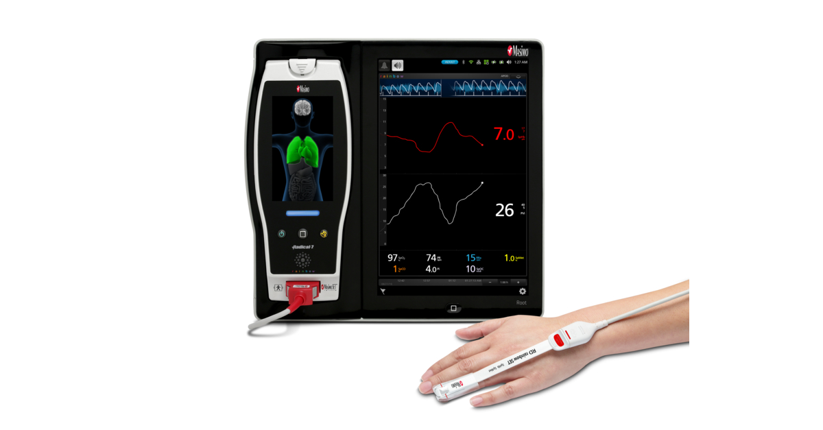 New Prospective Study Evaluates the Accuracy of Masimo SpHb ...
