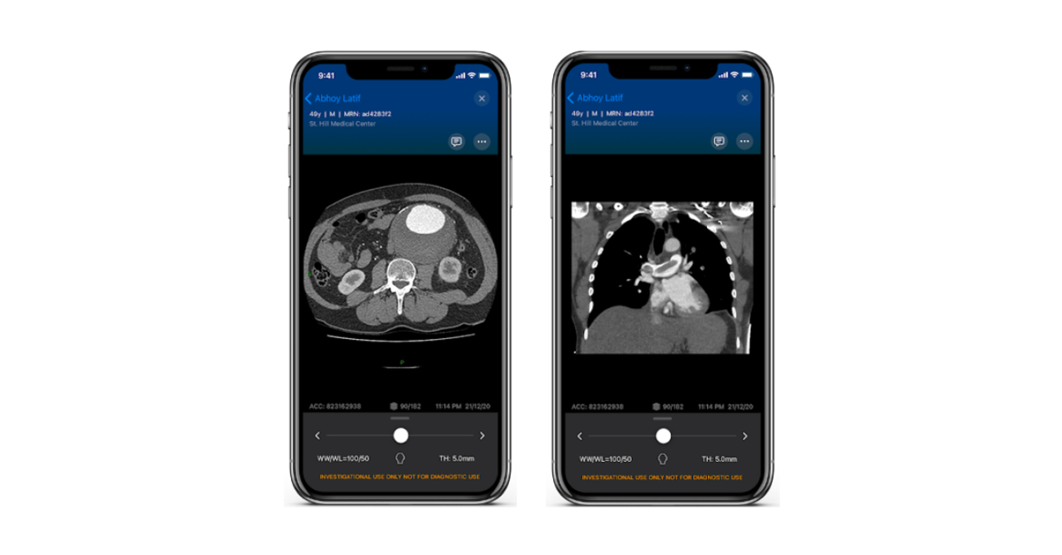 Viz.ai Launches AI-Powered Viz™ Vascular Suite | Business Wire