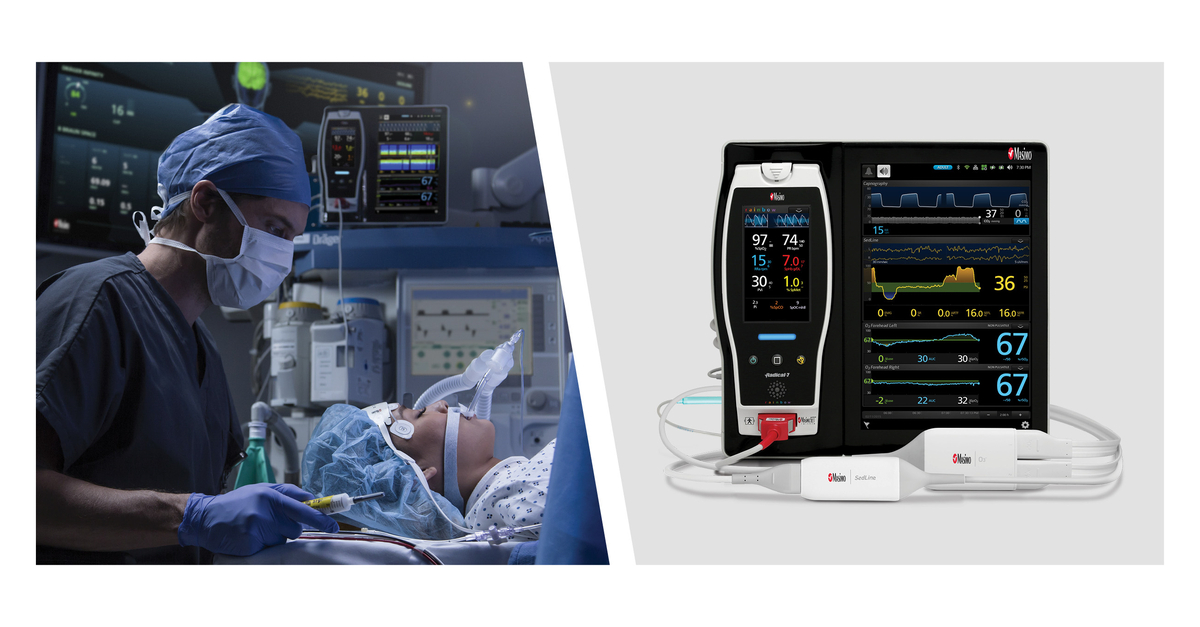 Samenvatting: Onderzoekers benutten de kracht van Masimo Root ...