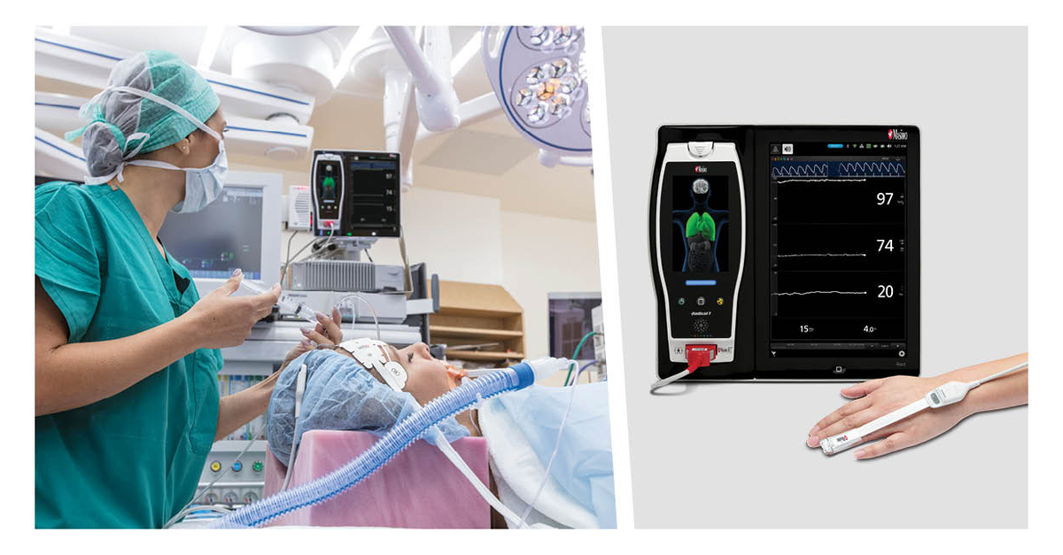 Nuevo estudio evalúa el uso de Masimo PVi® como indicador de la ...