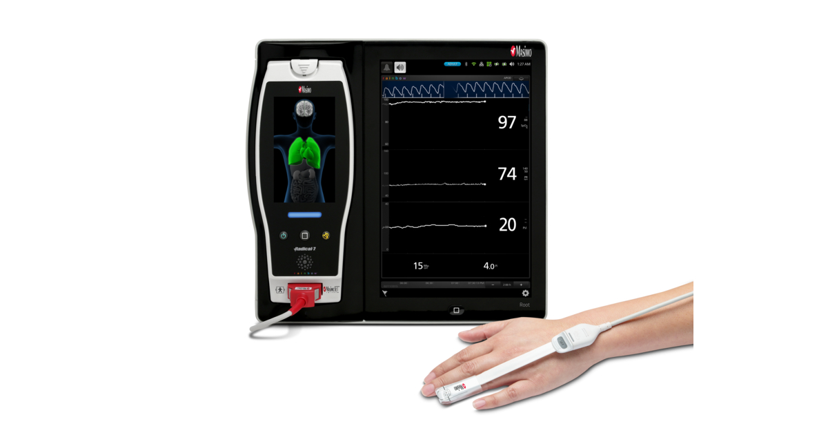 New Study Finds That Masimo PVi® Reliably Predicted Fluid ...