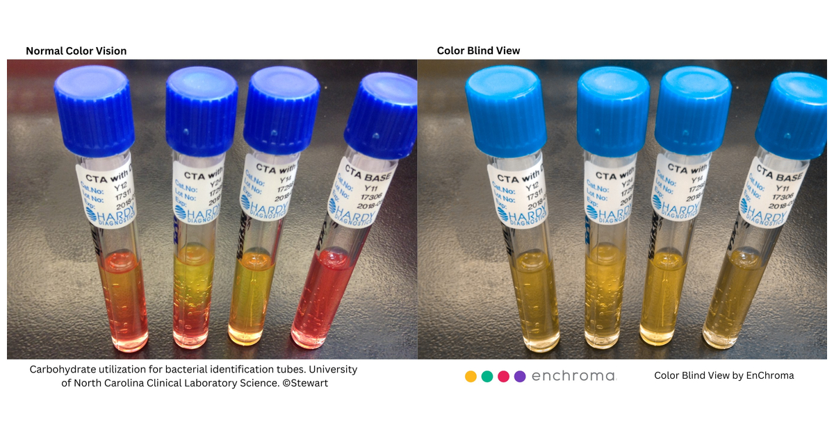 EnChroma and UNC’s Department of Health Sciences Team to Help Color ...