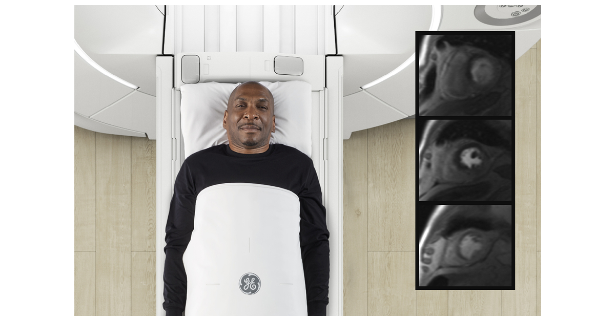 GE HealthCare Expands Contrast Media Portfolio with Launch of MRI Agent ...