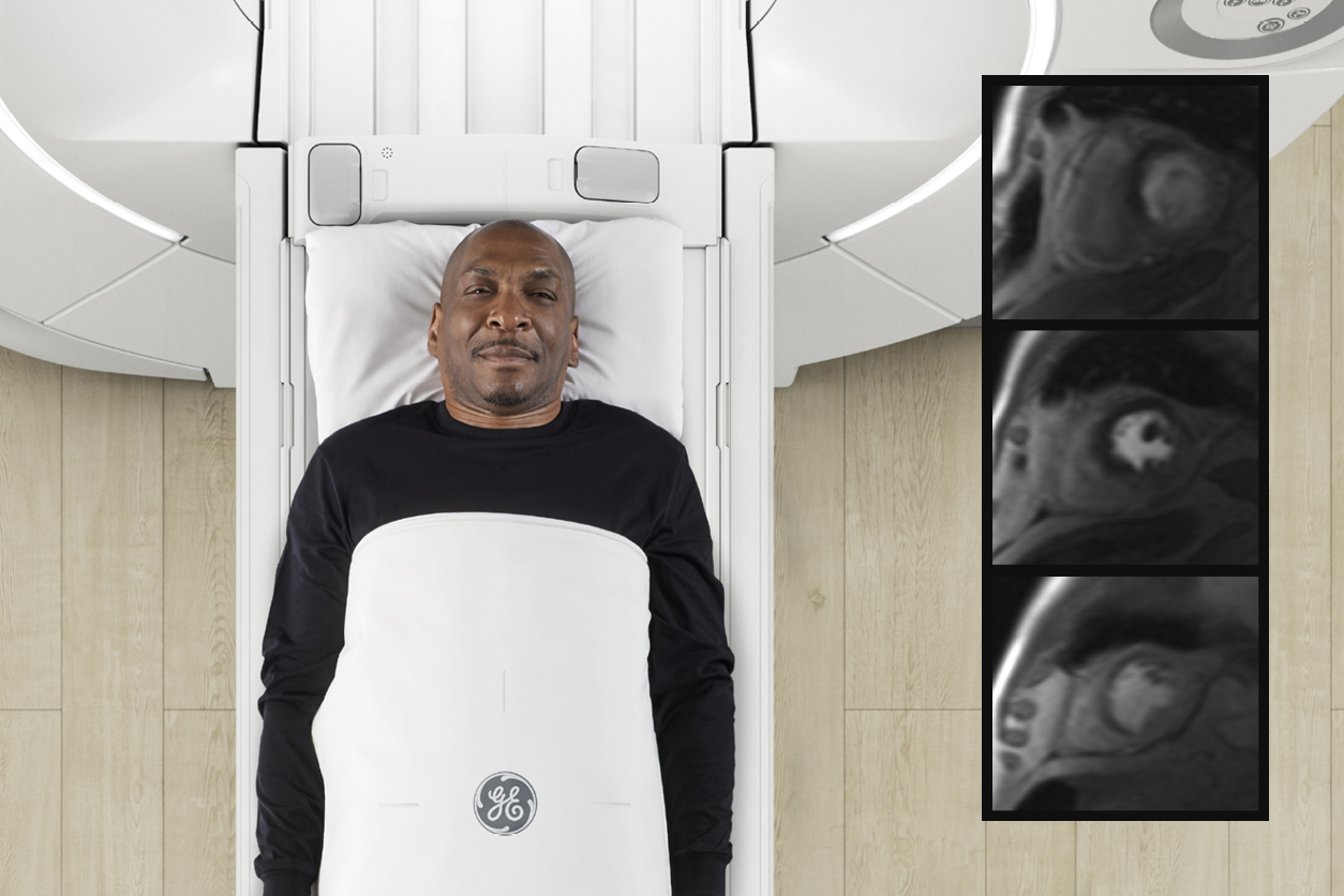 GE HealthCare Expands Contrast Media Portfolio with Launch of MRI Agent ...