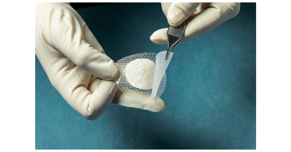 Kerecis Combines Fish-Skin Graft and Silicone Cover for Wound Treatment ...