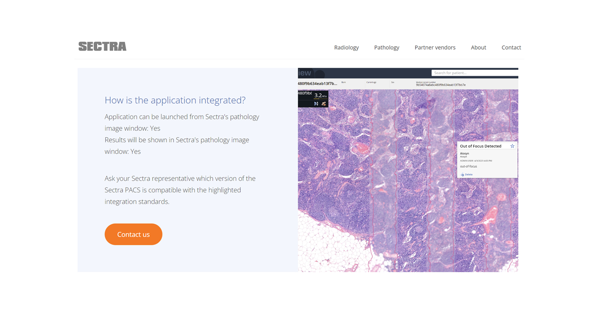 Aiosyn’s AI-powered Quality Control for Digital Pathology Slides Is Now Available in Sectra ...