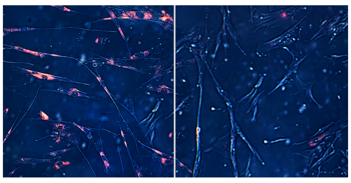 Artificial intelligence identifies anti-aging drug candidates targeting ...