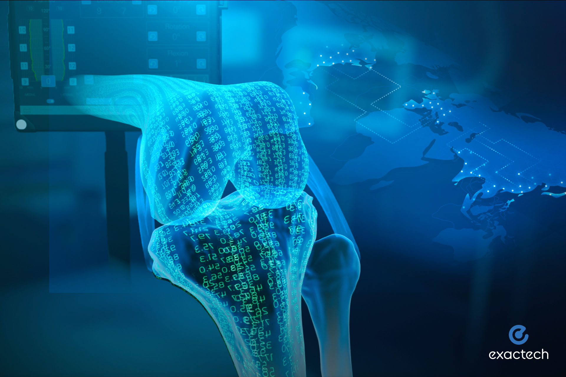 Exactech Accelerates International Expansion of Its Newton™ Balanced ...