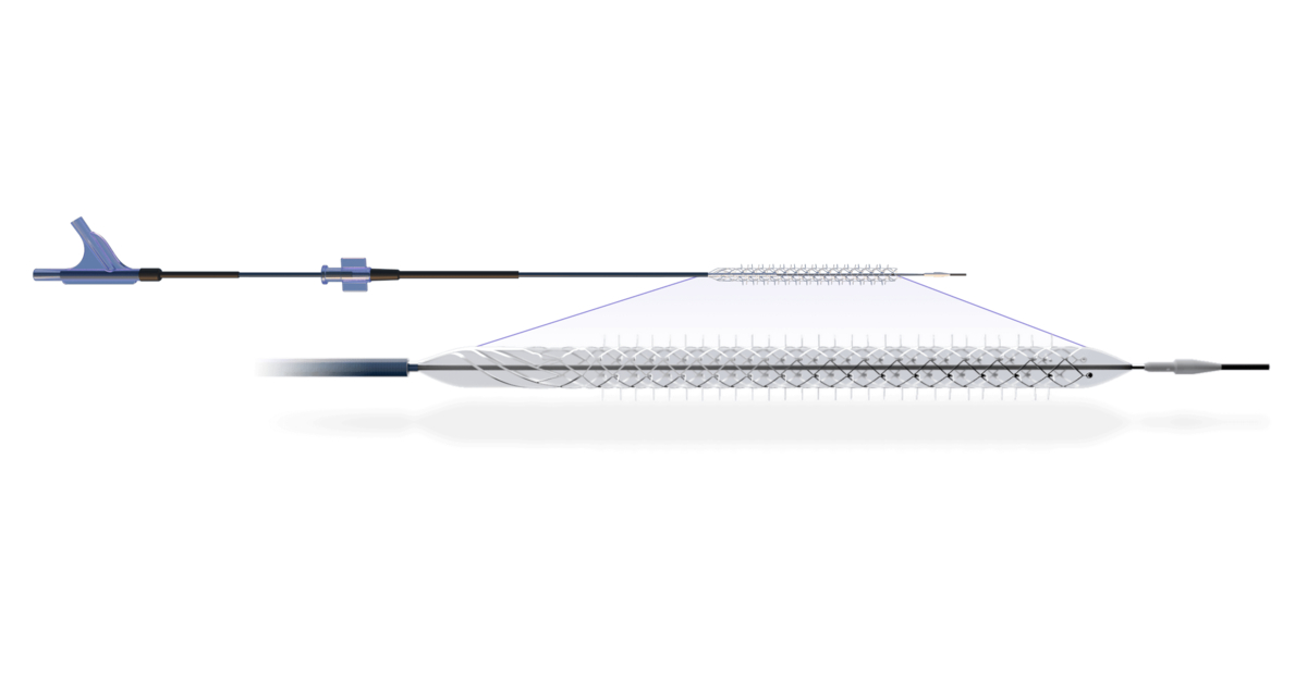 DEEPER OUS Trial Evaluating Reflow Medical’s Bare Temporary Spur Stent ...