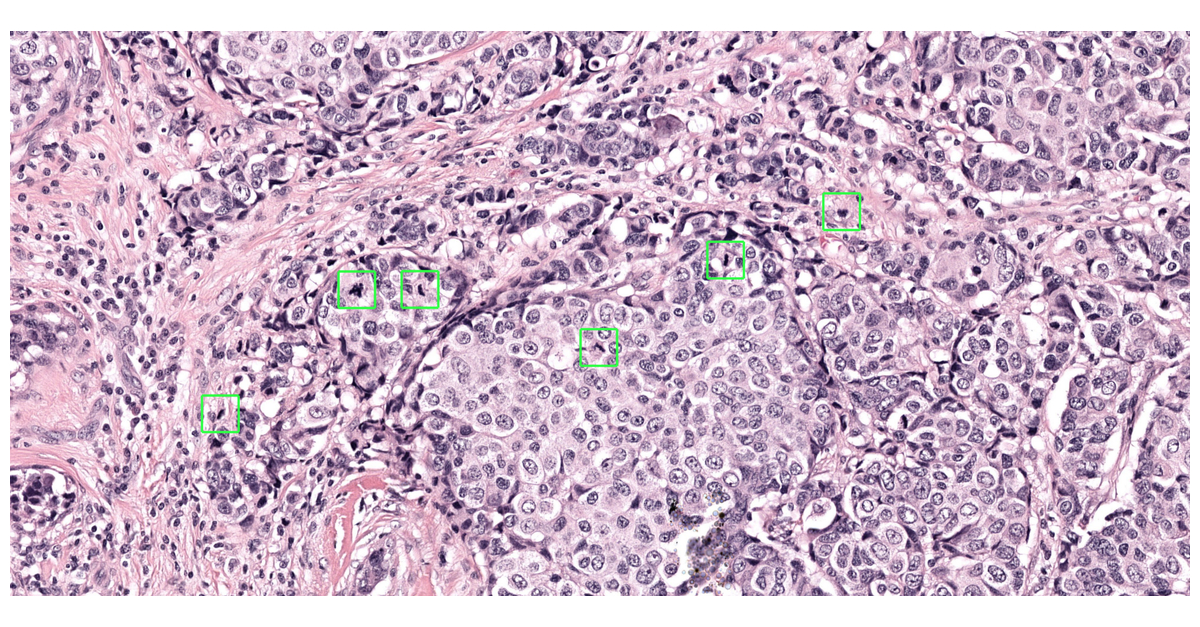 Aiosyn Launches AI-Powered Mitosis Detection Solution to Support Cancer ...