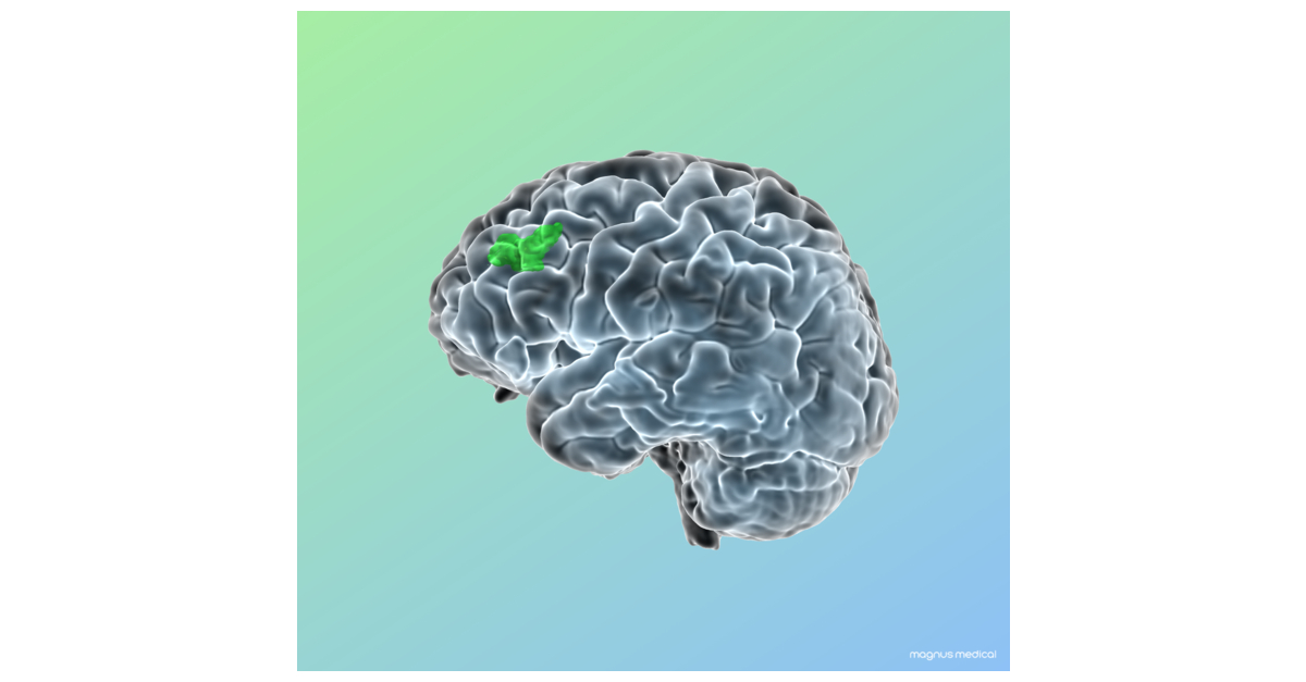 Magnus Medical Announces First Participants Treated in Study Using ...