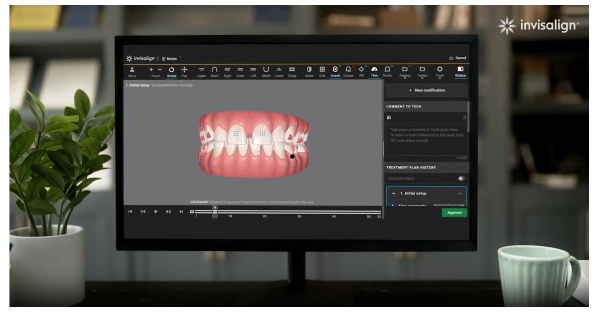 Align Technology Introduces New SmartForce™ Attachment-free Aligner ...