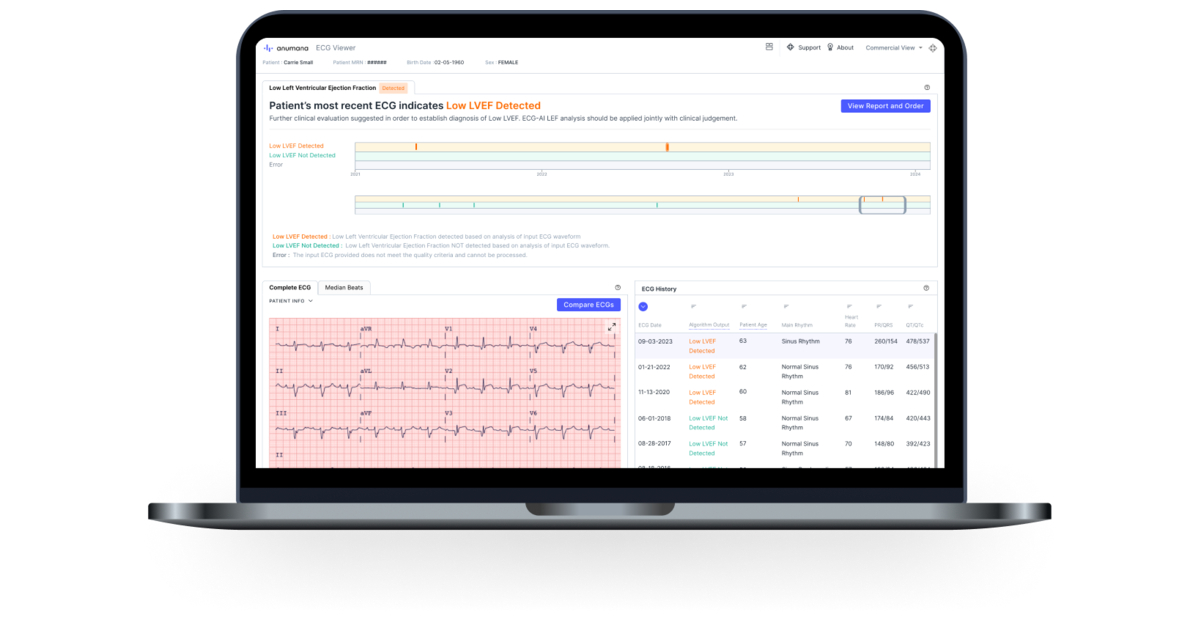 Anumana Receives U.S. FDA 510(k) Clearance for ECG-AI Algorithm to ...