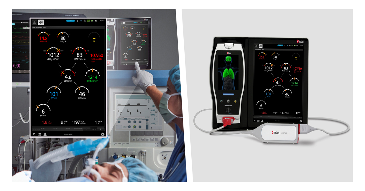 Masimo recibe el marcado CE MDR de la UE para el módulo de monitorización hemodinámica LiDCO ...