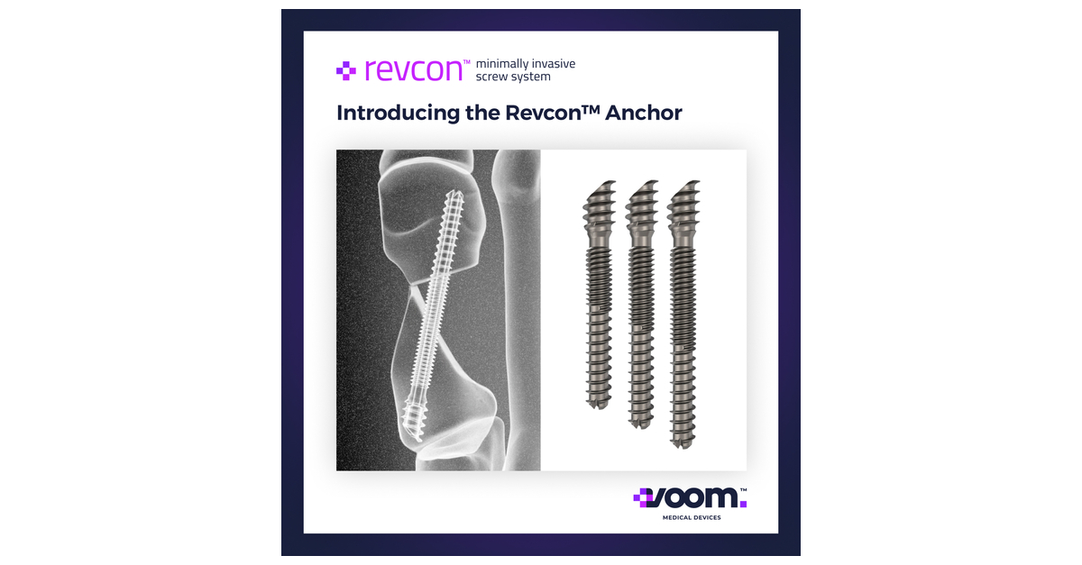 Groundbreaking Advancement in Minimally Invasive Bunion Surgery (MIBS ...