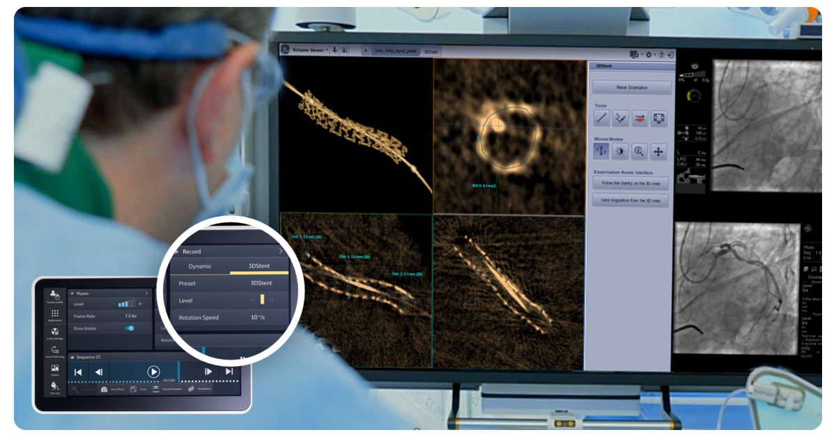 GE HealthCare Announces New Innovations and Collaborations in Image ...