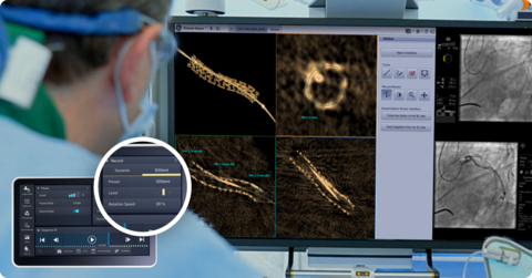 GE HealthCare Announces New Innovations and Collaborations in Image ...