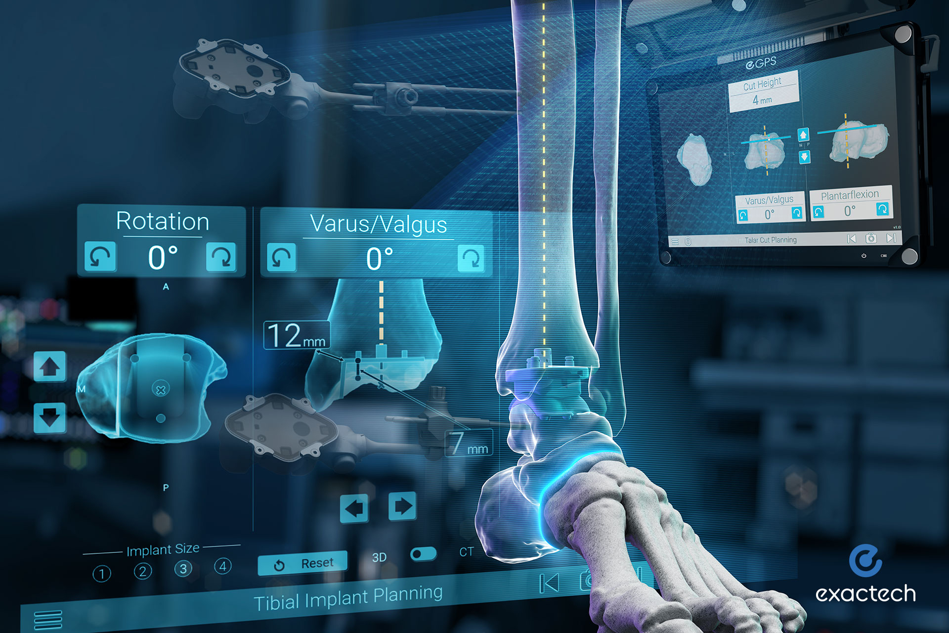 Exactech Announces FDA 510(k) Clearance of the World’s First Surgical ...